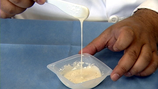 Utah doctor using 'Kryptonite' to fuse bones | KSL.com