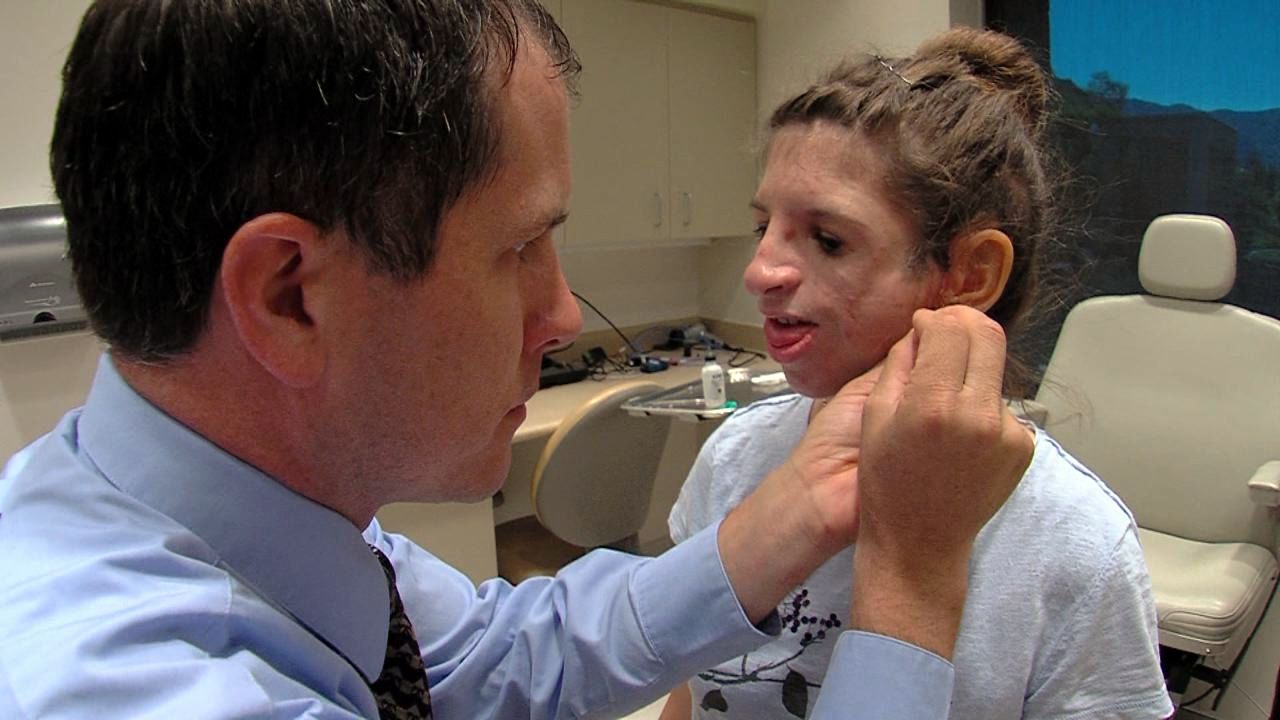 Teen receives set of prosthetic ears | KSL.com